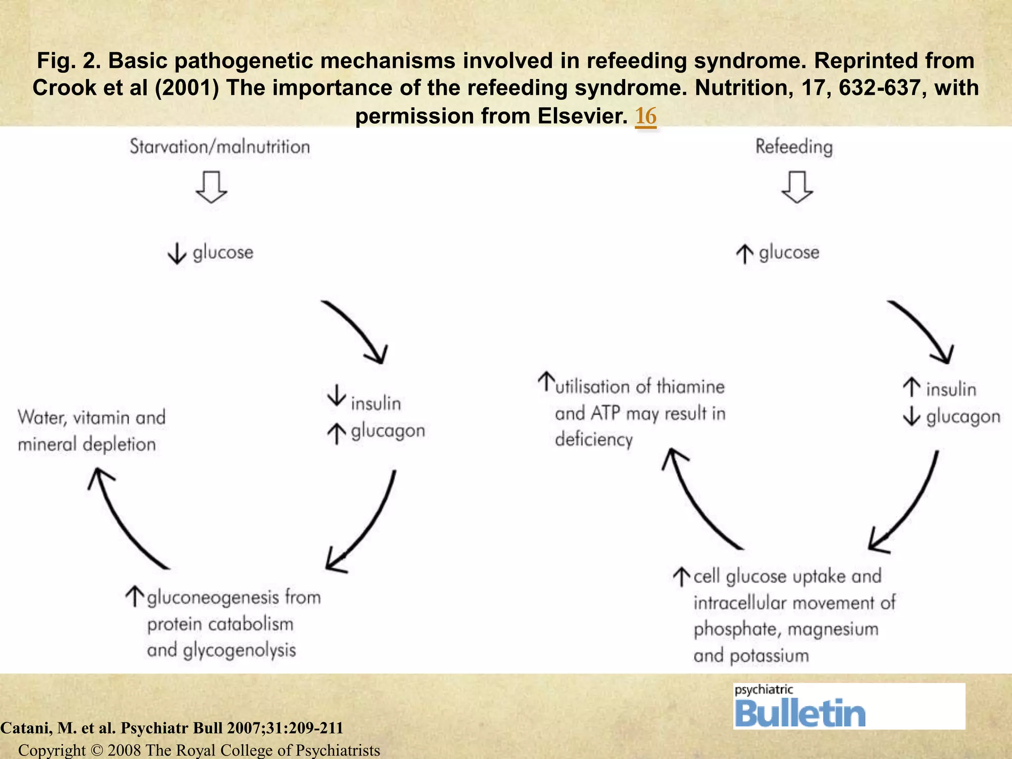 Refeeding syndrome | POTX