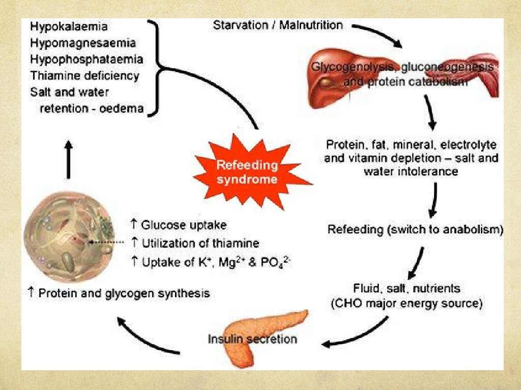 Refeeding syndrome