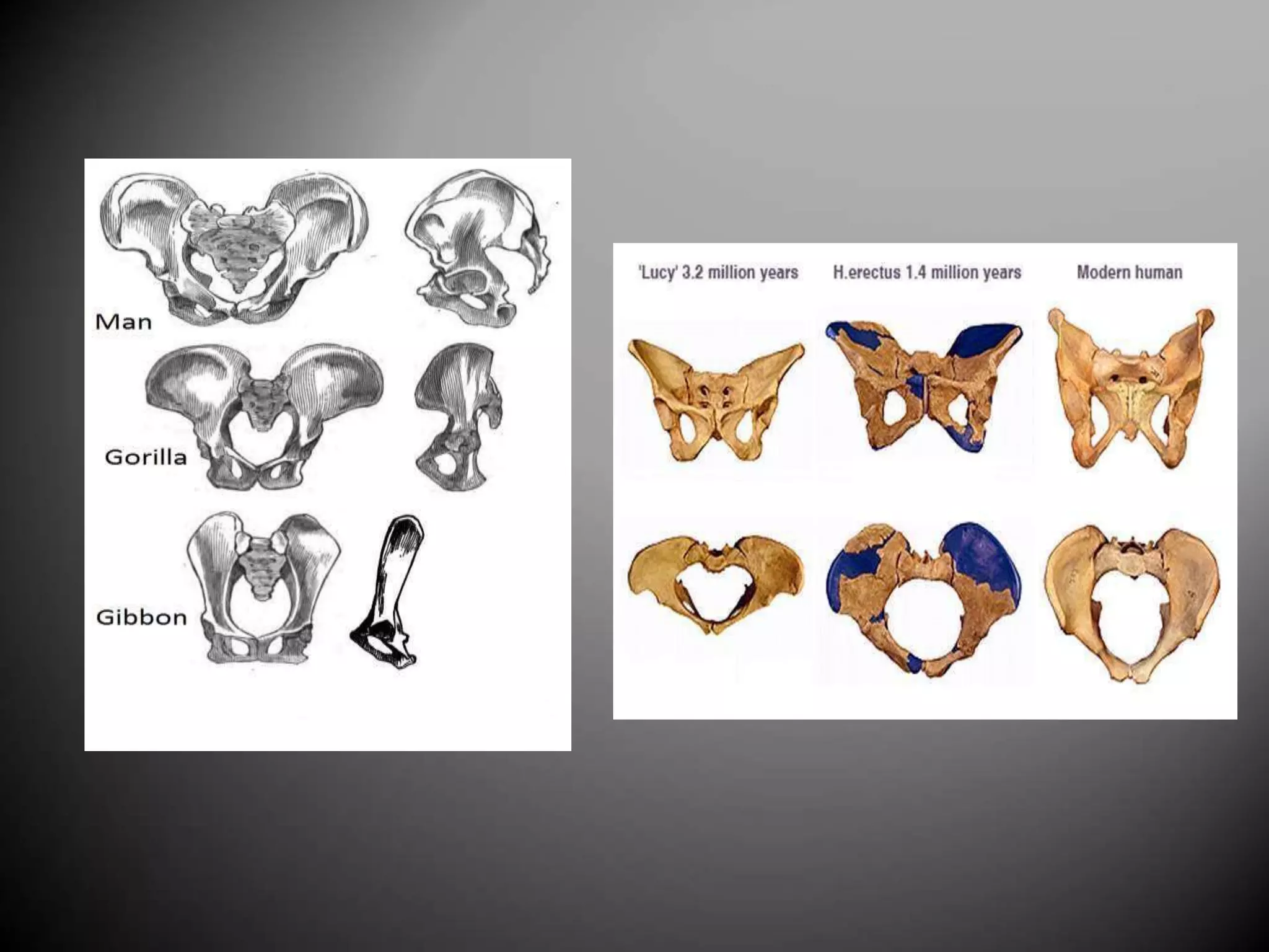 Referat - Bazinul Osos.docx