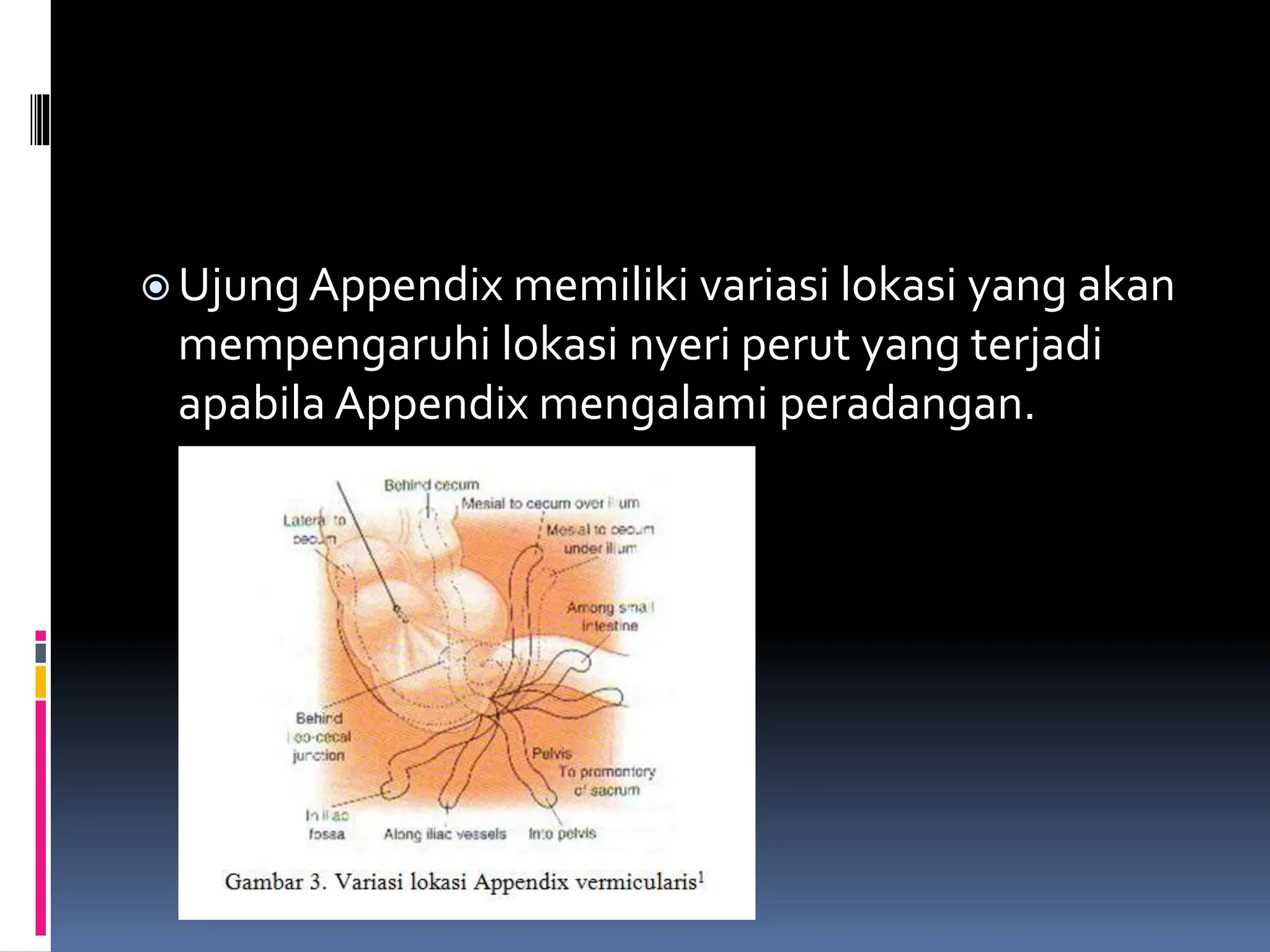 Appendicitis adalah peradangan yang terjadi pada Appendix vermicularis. Appendicitis merupakan ...