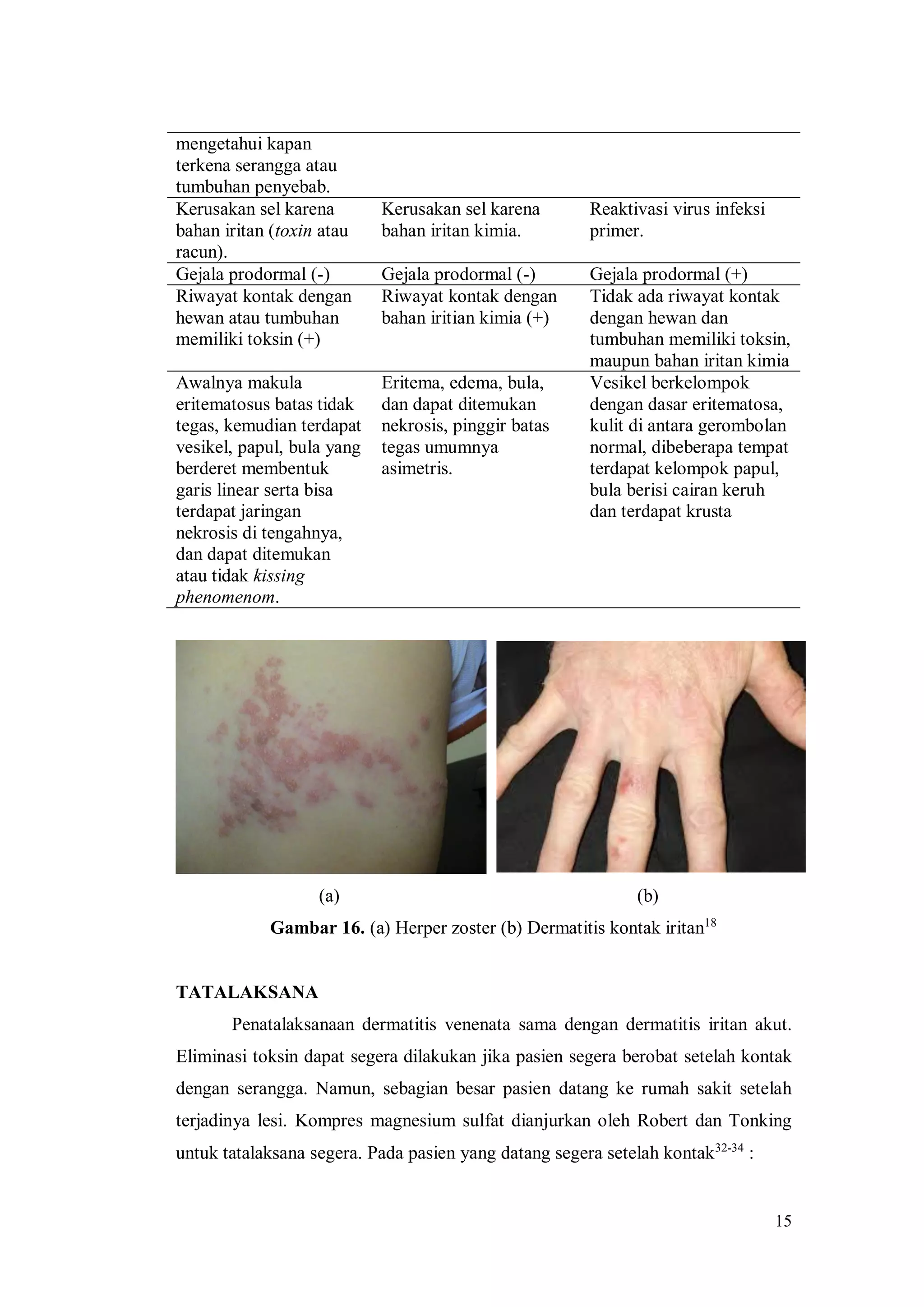 REFERAT DERMATITIS VENENATA-dr.EHD.pdf