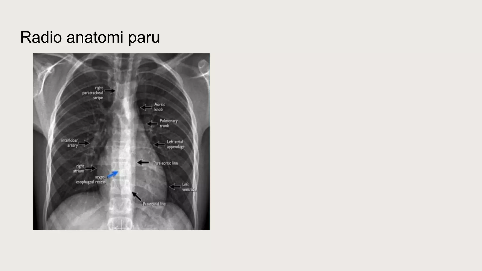 REFERAT EDEM PARU.pptx