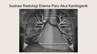 REFERAT EDEM PARU.pptx