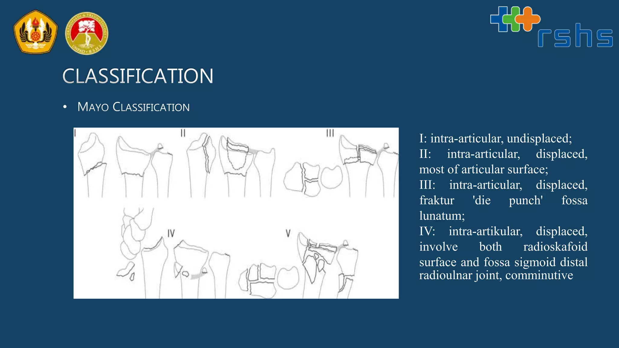 Referat Hand 2- Distal Radius Fracture-Reza Devianto Hambali, dr.pptx