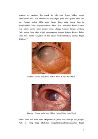 Referat kegawatdaruratan mata | DOCX