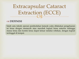 REFERAT OPERASI KATARAK PADA MATA (JENIS OPERASI DAN INDIKASINYA).pptx