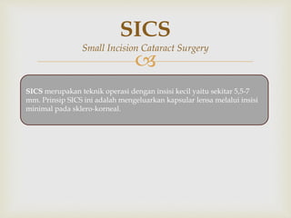 REFERAT OPERASI KATARAK PADA MATA (JENIS OPERASI DAN INDIKASINYA).pptx