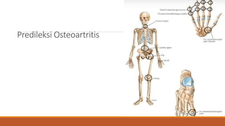 referat osteoartritis.pptx