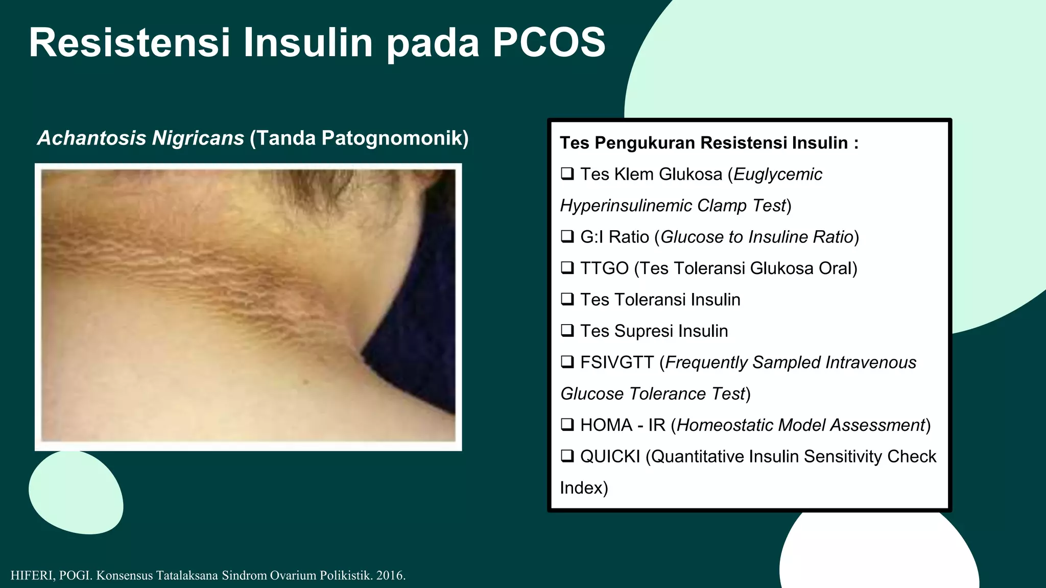 REFERAT PCOS - pptx | PPTX