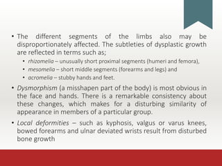 Referat pedi I-Anggrian-HYPOPLASIA OF FEMUR.pptx
