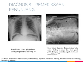 referat peritonitis.pptx