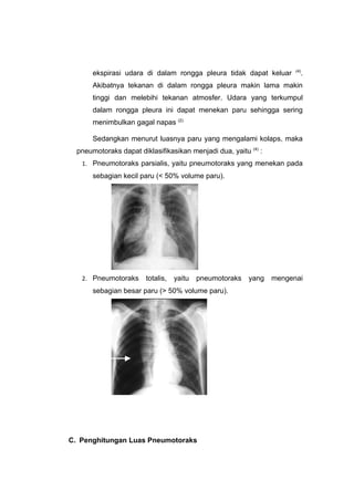Referat pneumothorax | DOC