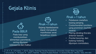 Referat Radiologi Rickets (Rakhitis) | PPTX