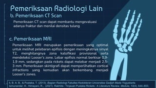 Referat Radiologi Rickets (Rakhitis) | PPTX