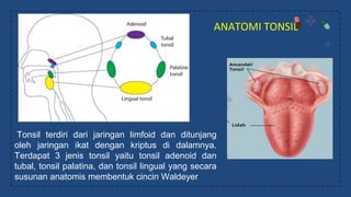 REFERAT TONSILITIS tht.pptx