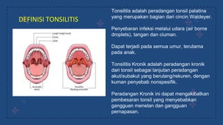 REFERAT TONSILITIS tht.pptx