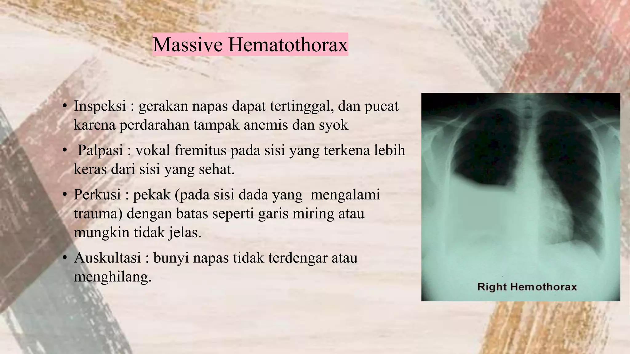 Referat TRAUMA THORAKS Marni.pptx