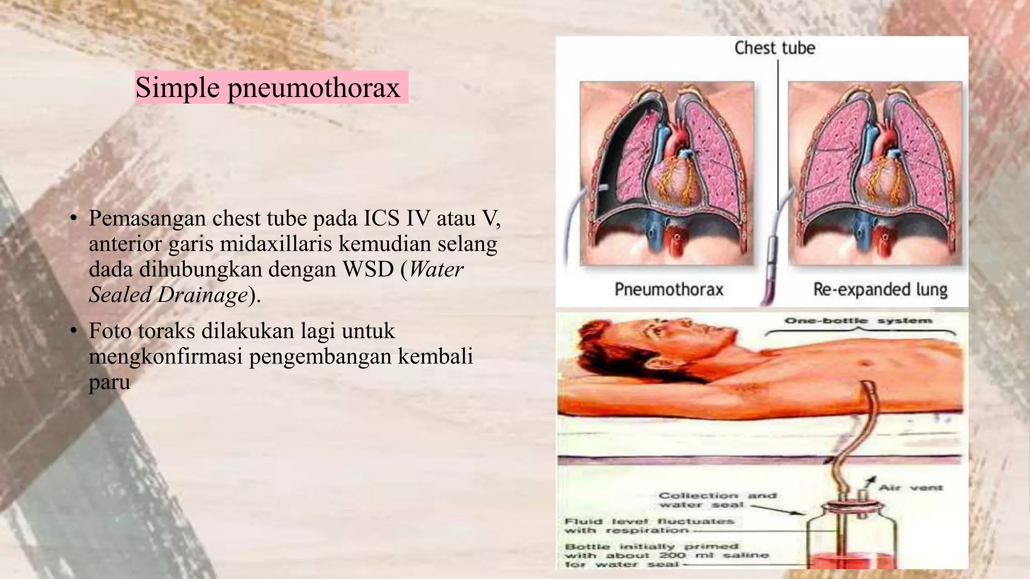 Referat TRAUMA THORAKS Marni.pptx