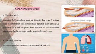 Referat TRAUMA THORAKS Marni.pptx