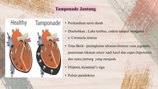 Referat TRAUMA THORAKS Marni.pptx