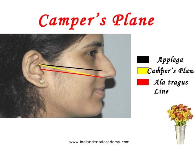 Reference plane/ oral surgery courses