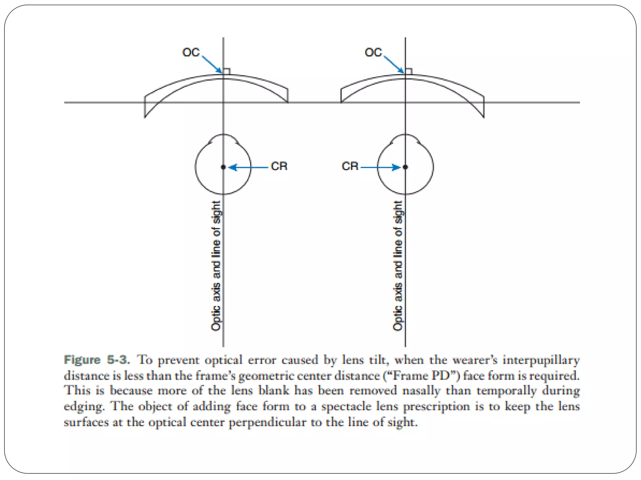 Reference point placement, multi focal height and blank size ...