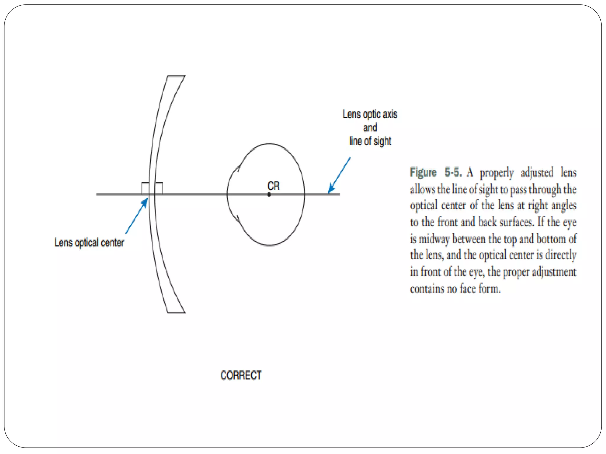 Reference point placement, multi focal height and blank size ...