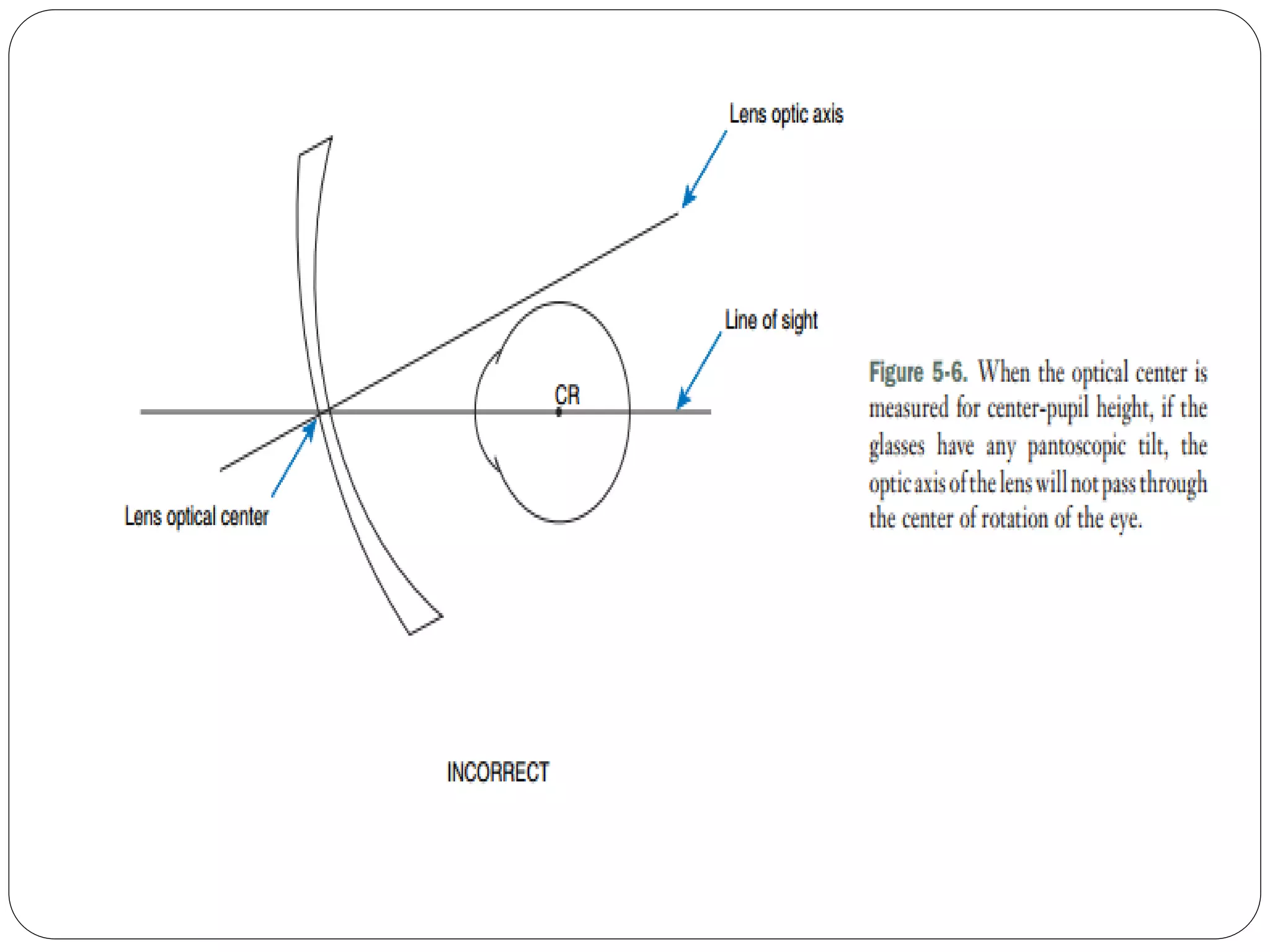 Reference point placement, multi focal height and blank size ...