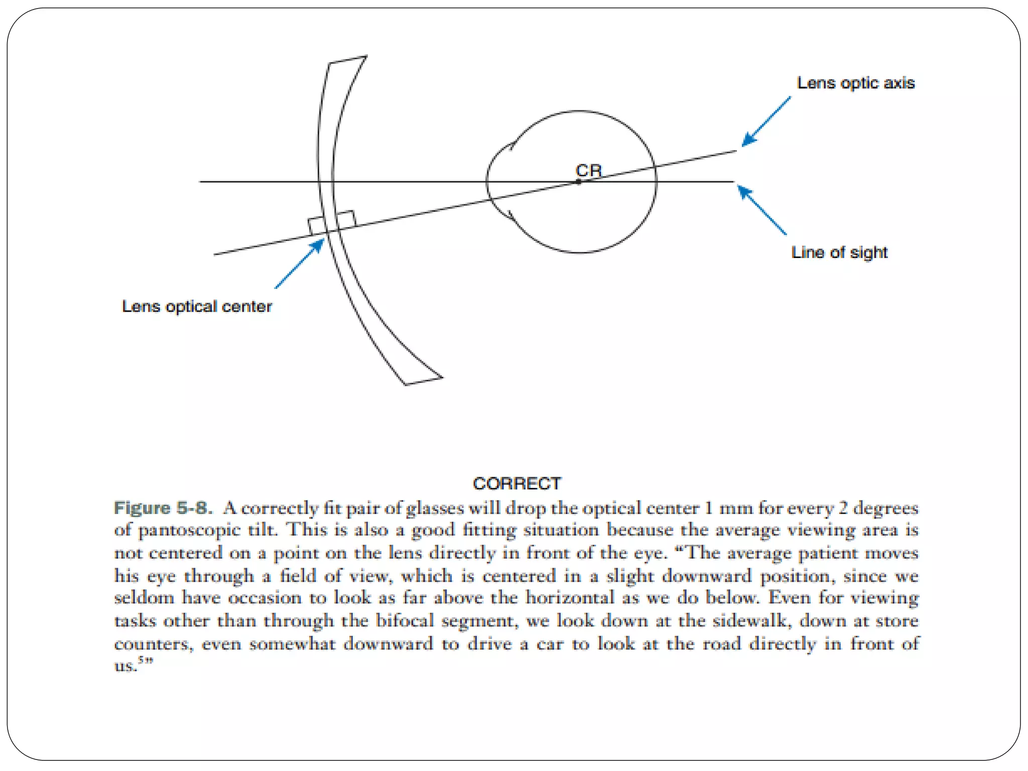 Reference point placement, multi focal height and blank size ...