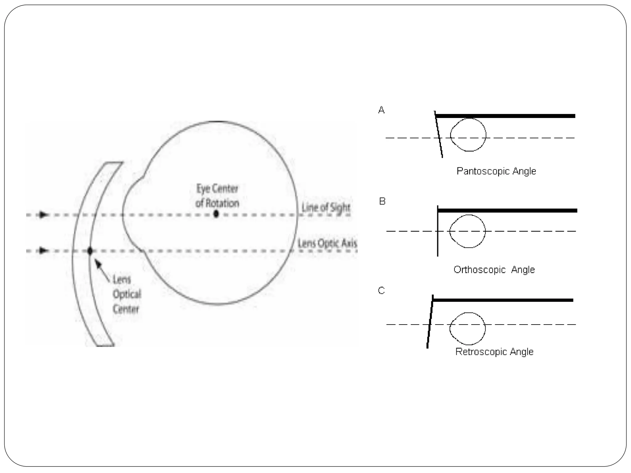 Reference point placement, multi focal height and blank size ...