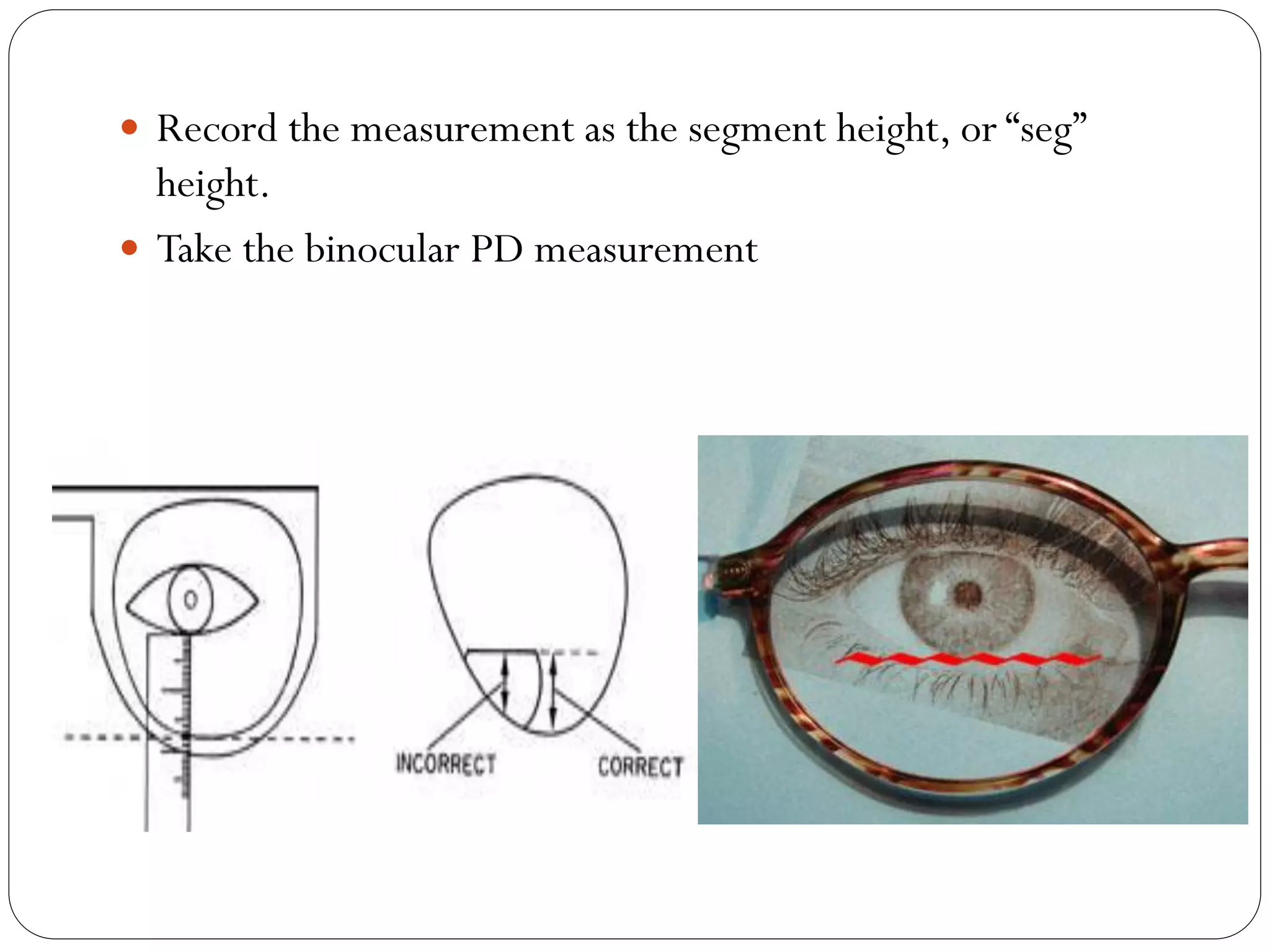 Reference point placement, multi focal height and blank size ...
