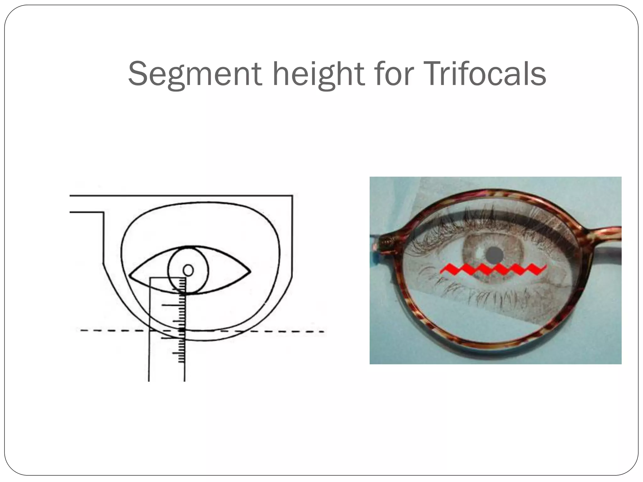 Reference point placement, multi focal height and blank size ...