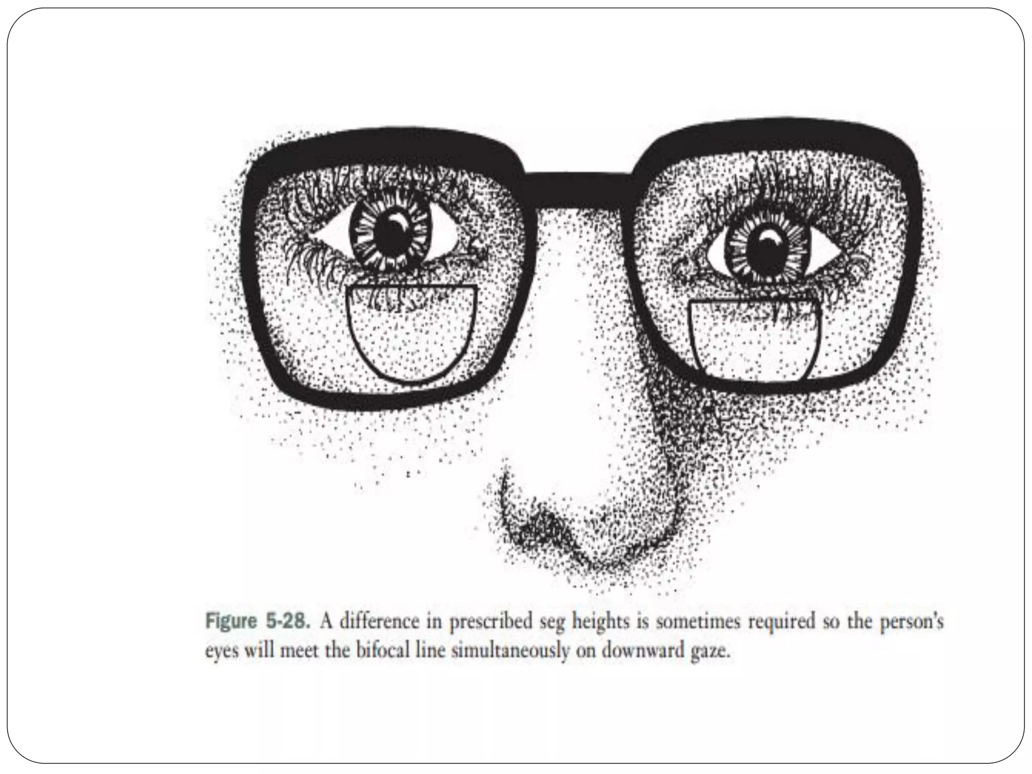 Reference point placement, multi focal height and blank size ...