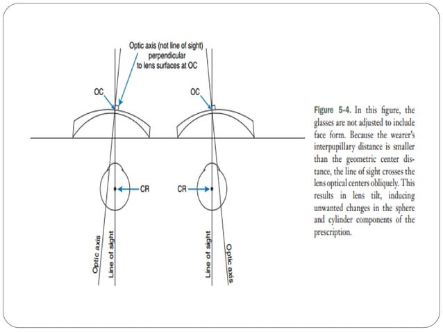 Reference point placement, multi focal height and blank size ...