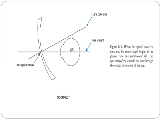 Reference point placement, multi focal height and blank size ...