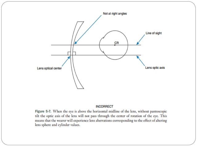 Reference point placement, multi focal height and blank size ...