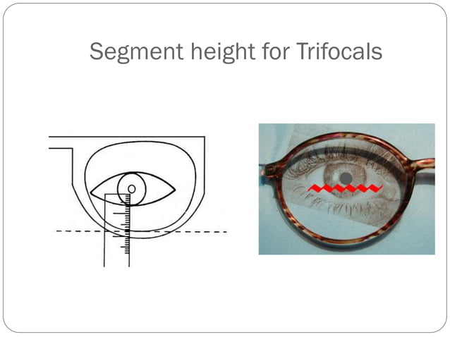 Reference point placement, multi focal height and blank size ...