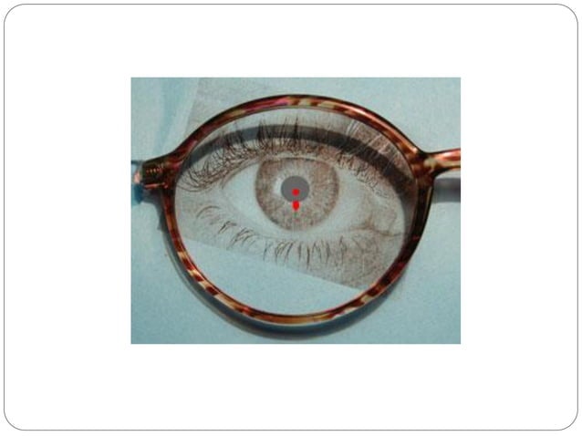 Reference point placement, multi focal height and blank size ...