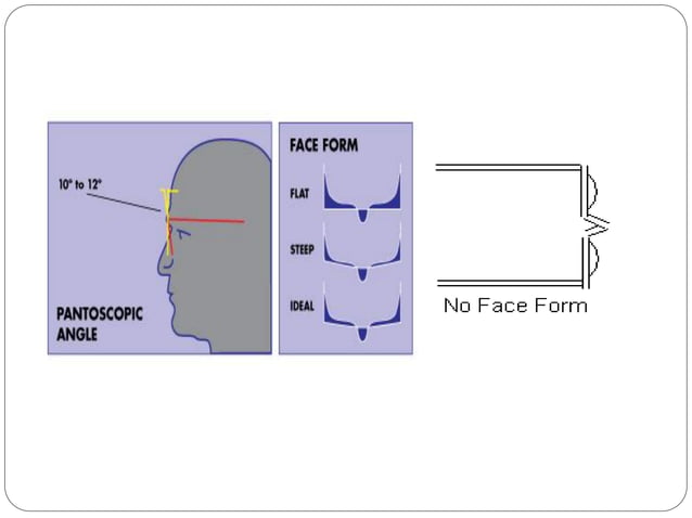 Reference point placement, multi focal height and blank size ...