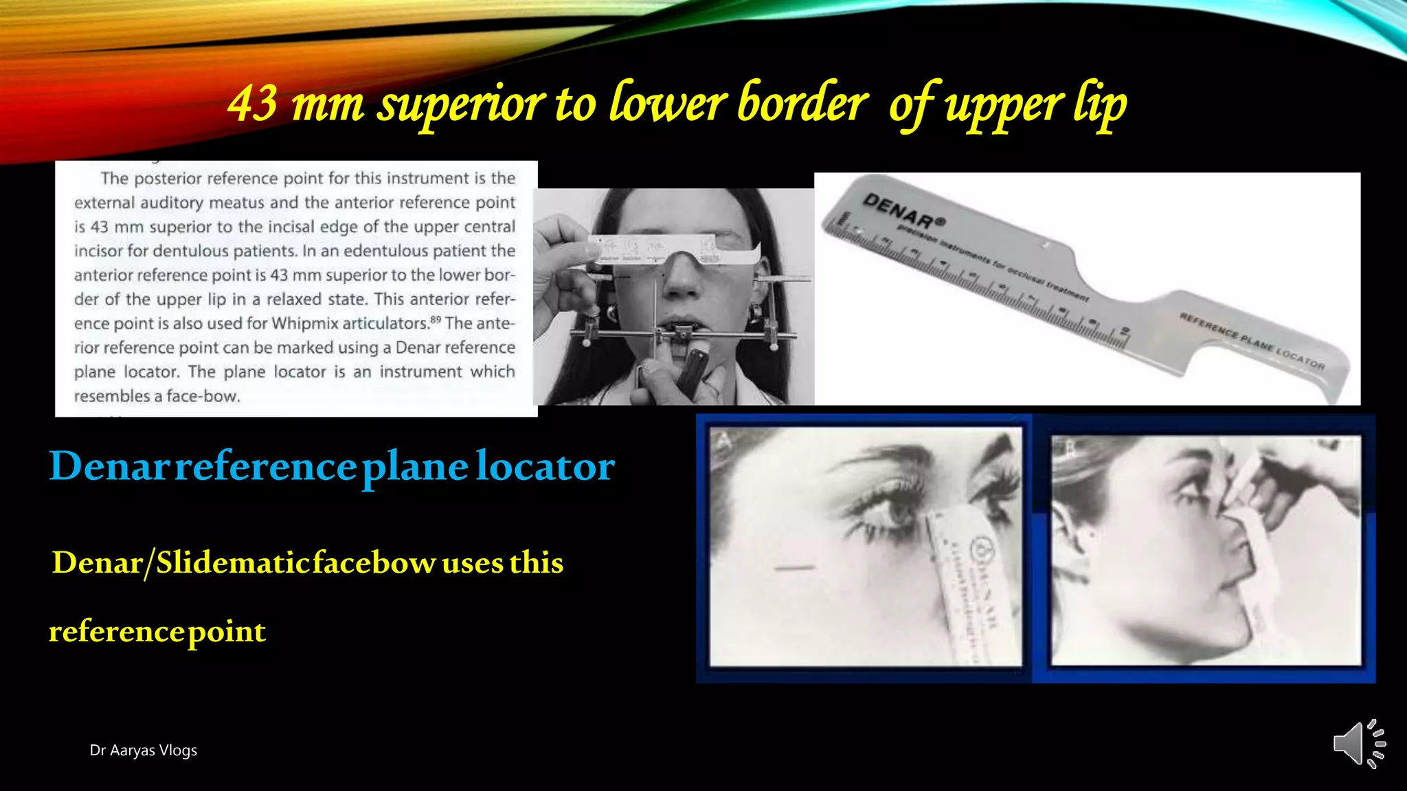 Reference points for facebow | PPTX