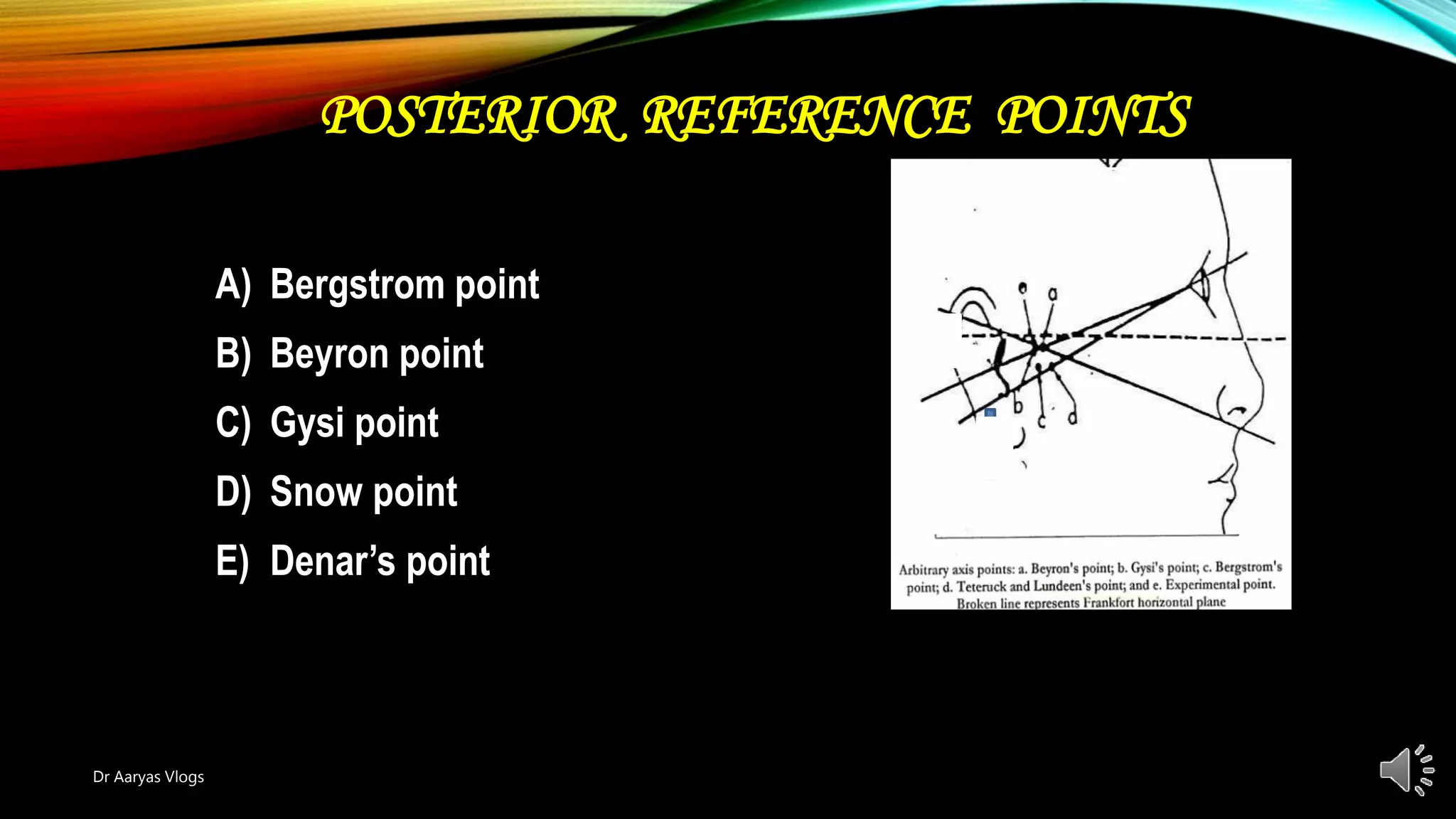 Reference points for facebow | PPTX