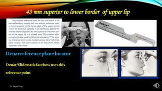Reference points for facebow | PPTX