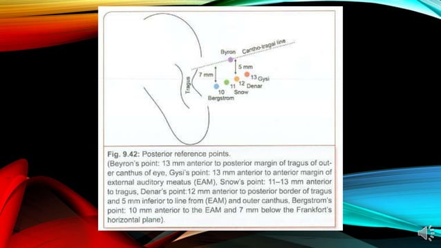 Reference points for facebow | PPTX