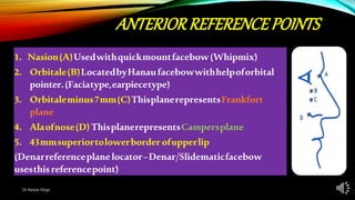 Reference points for facebow | PPTX