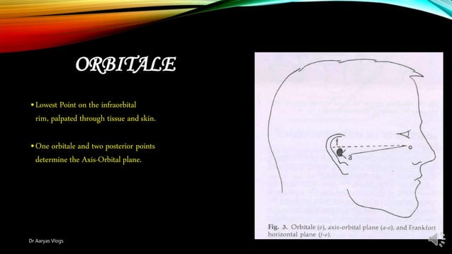 Reference points for facebow | PPTX