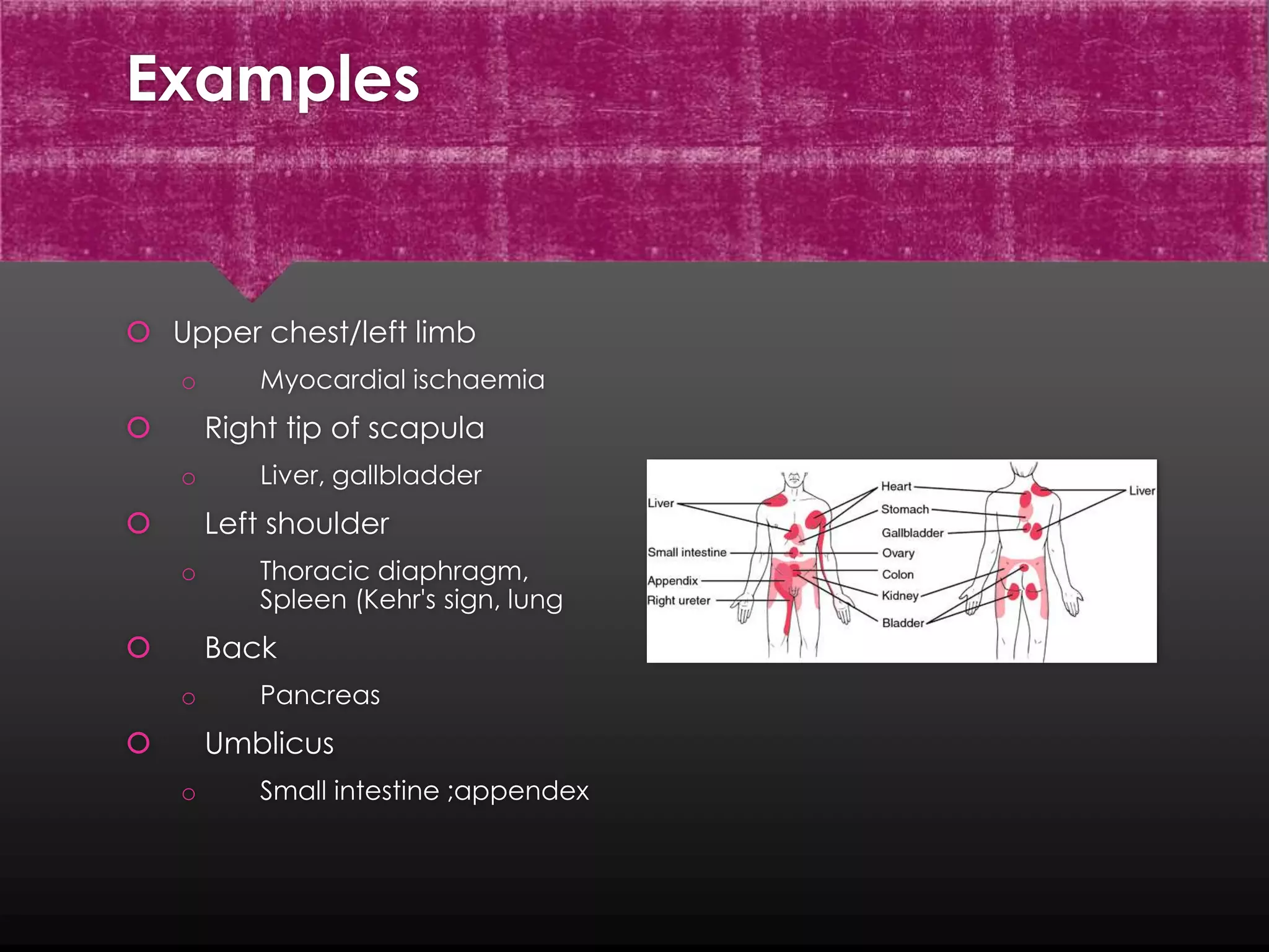 Referred Pain (Physiology Seminar) | PPTX