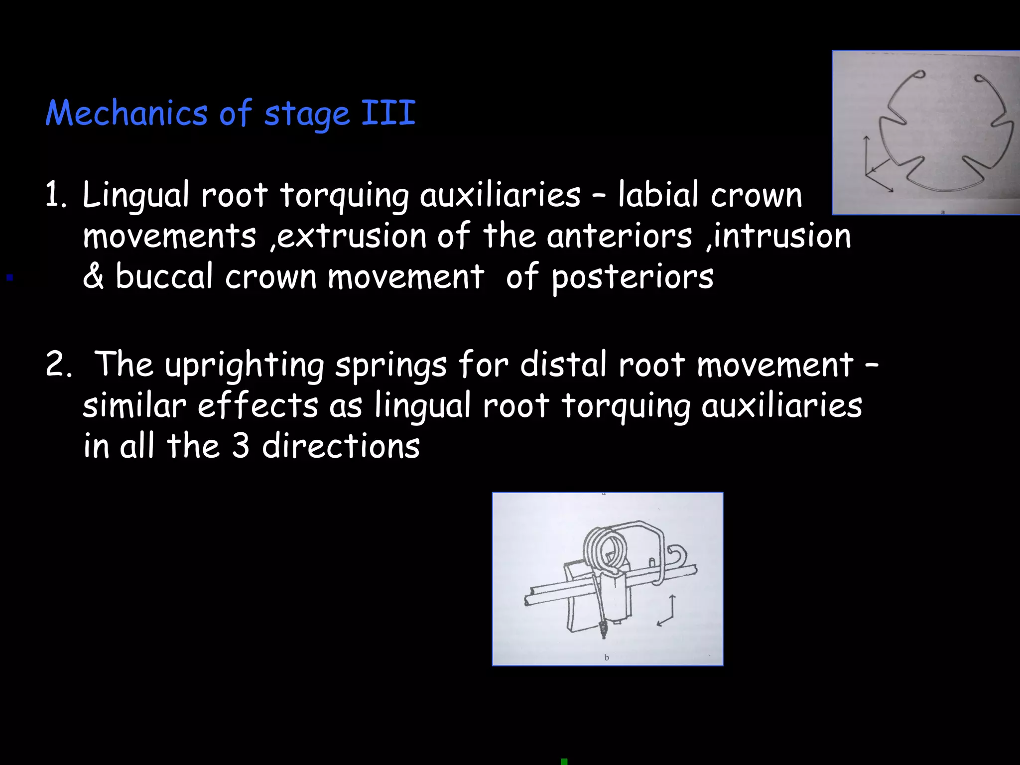 Refined begg technique | PPT