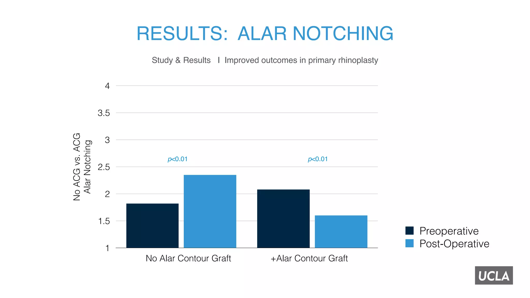 Refinements and advances in rhinoplasty with alar contour grafts | PDF