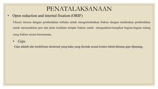 Refka Fraktur Humerus.pptx