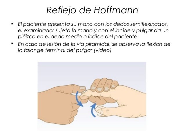 Reflejo cubitopronador